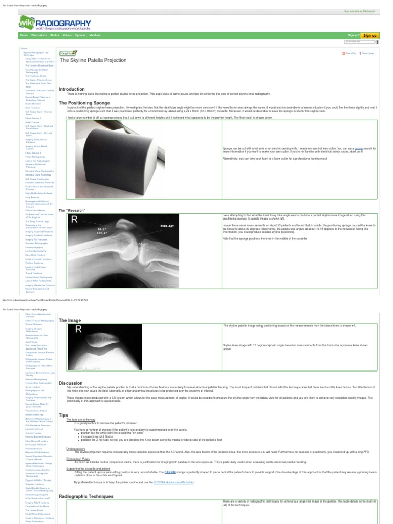 Skyline Patella Projection Techniques | PDF | Knee | Radiography