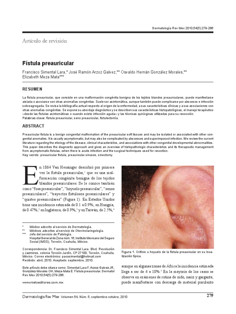 Fístula Preauricular Pdf