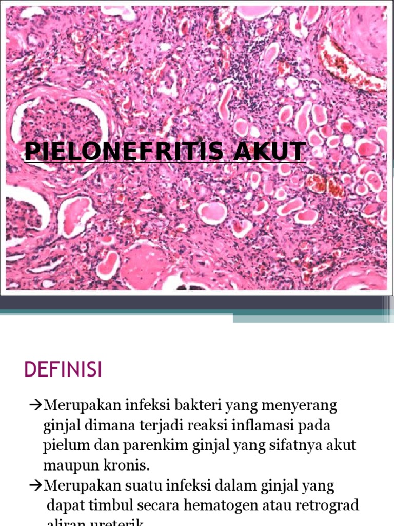 Pielonefritis Akut | PDF