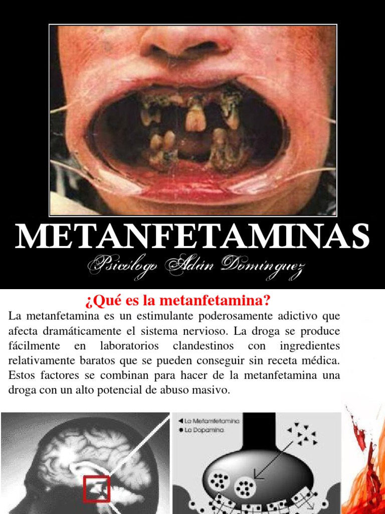 05 Metanfetaminas 110415121840 Phpapp02 PDF | PDF | Metanfetamina | Drogas