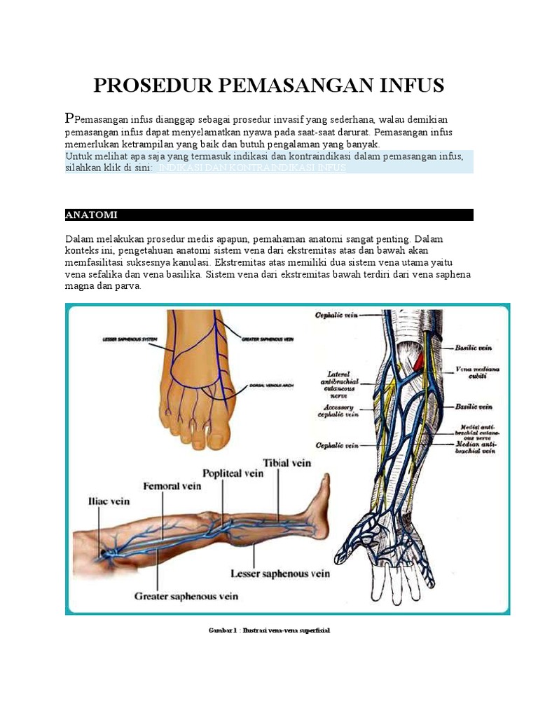 Prosedur Pemasangan Infus | PDF