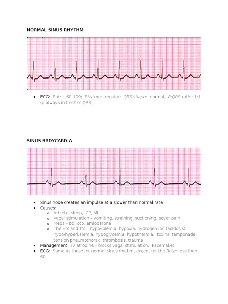 ECG Strips | PDF | Cardiac Electrophysiology | Heart