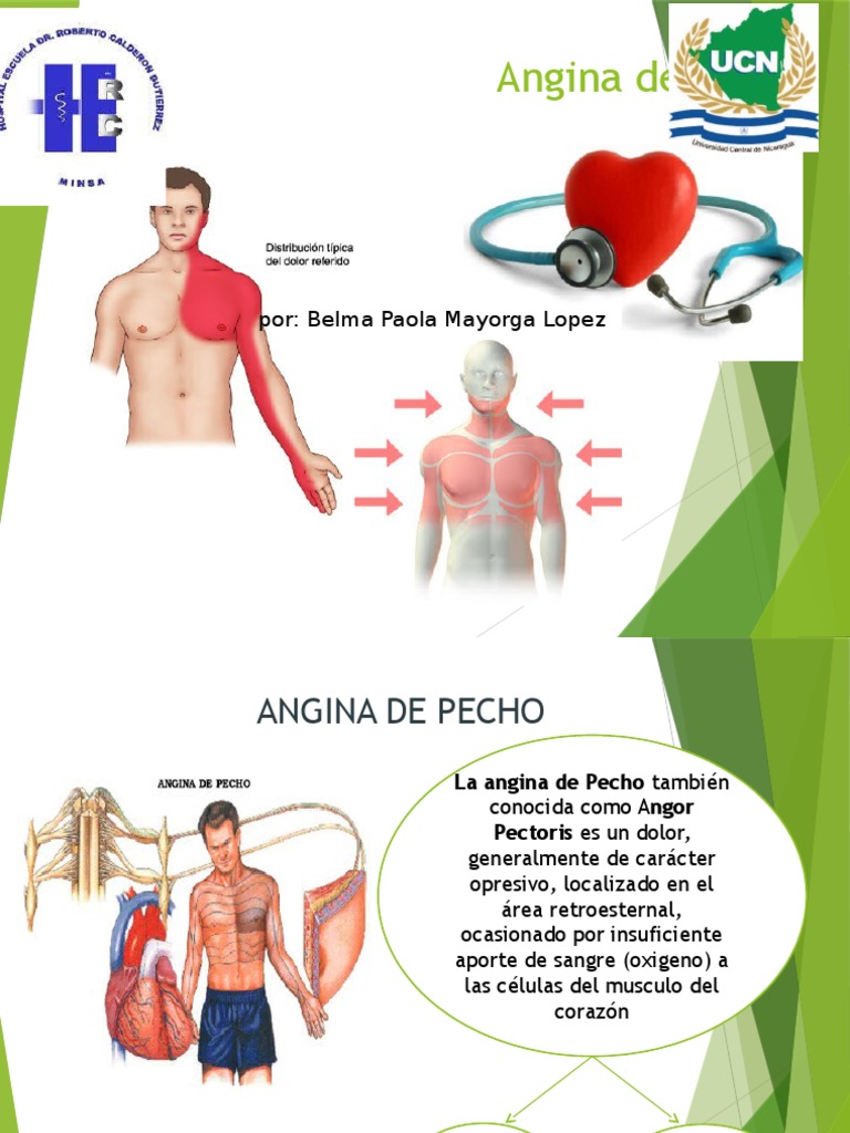 Angina de Pecho Final | PDF | Angina de pecho | Cardiología