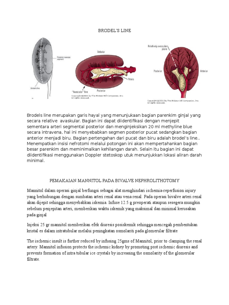 Brodel Line | PDF