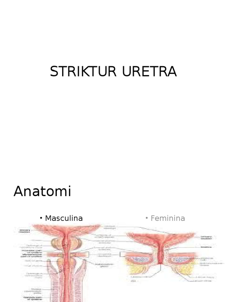 STRIKTUR URETRA