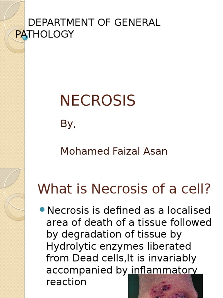 Understanding Necrosis in Pathology | PDF | Necrosis | Clinical Medicine