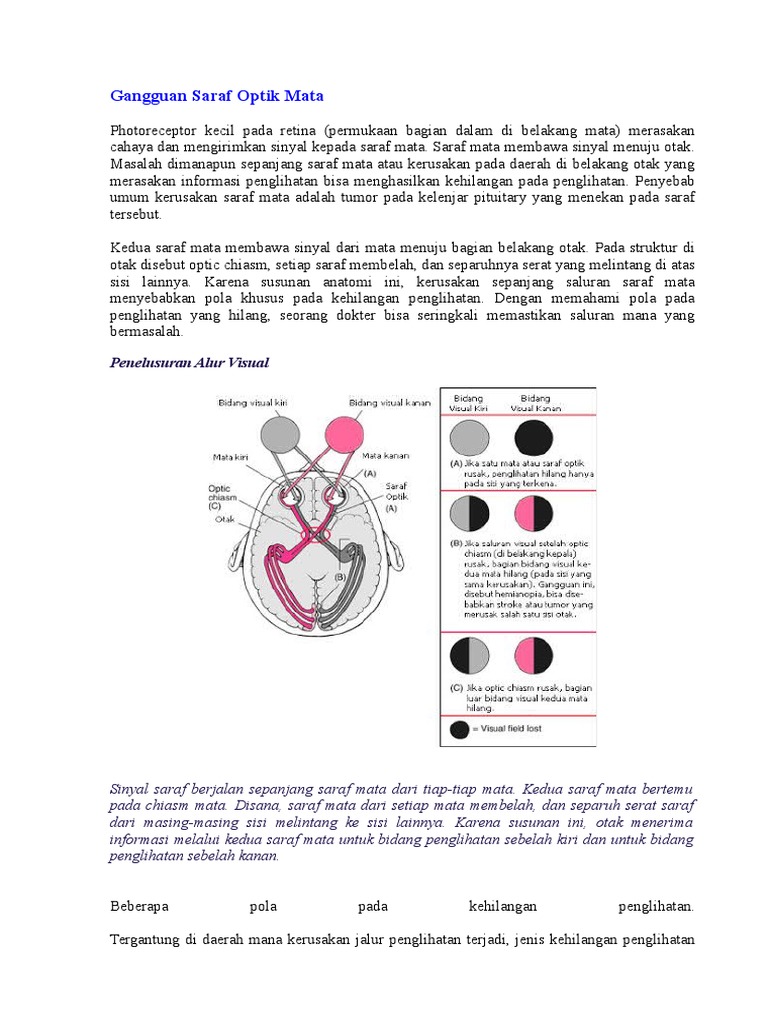 Gangguan Saraf Optik Mata | PDF