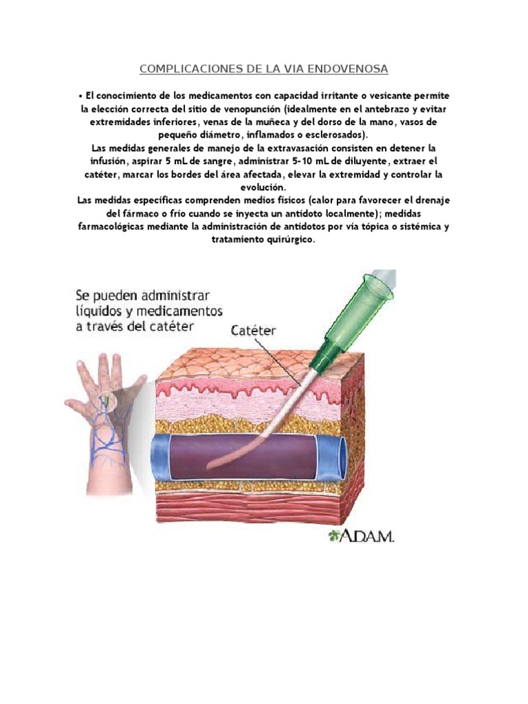 Complicaciones de La via Endovenosa | Terapia intravenosa ...