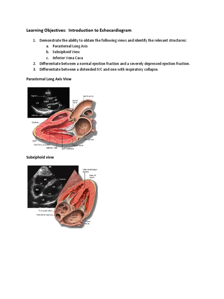 Intro To Echocardiogram Part I | PDF