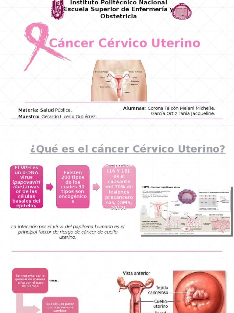 Cancer Cervicouterino | PDF | Cáncer de cuello uterino | Especialidades Medicas