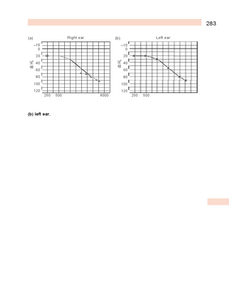 Oxford Handbook ENT | PDF