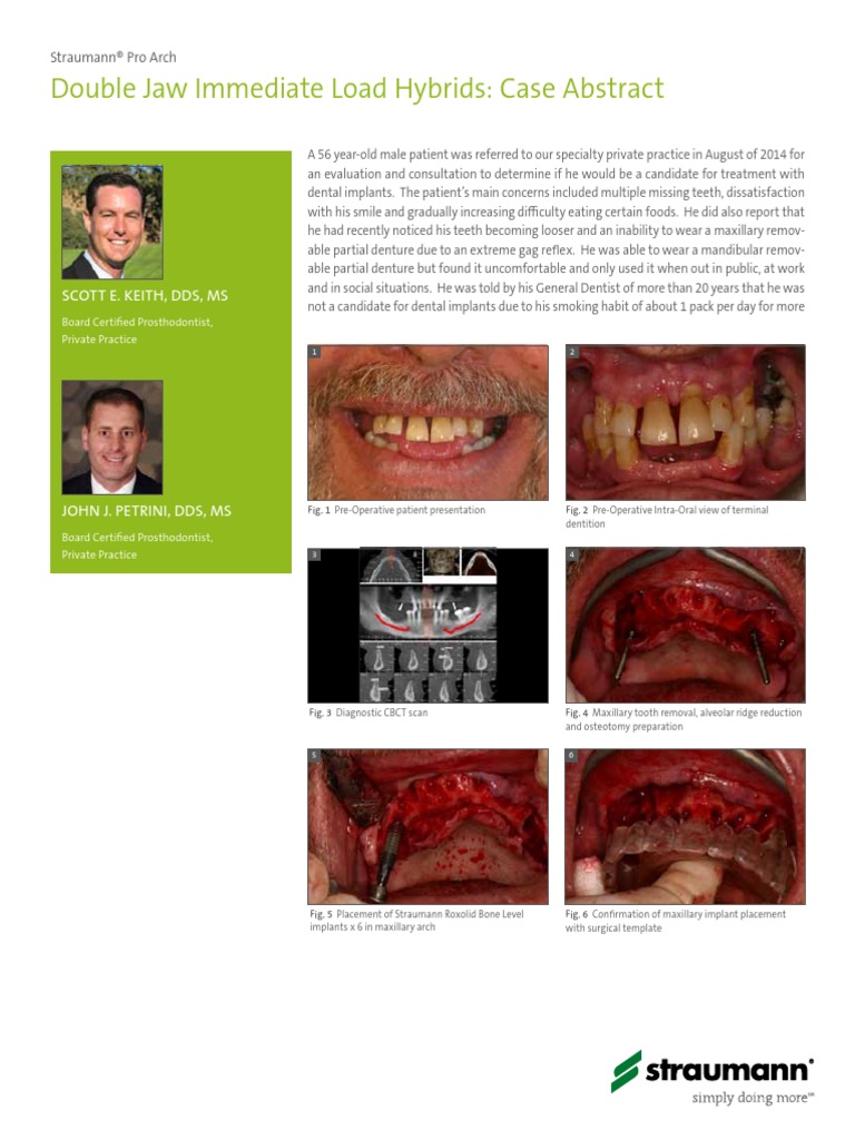 Straumann Pro Arch DR Keith | PDF | Dental Implant | Dentures