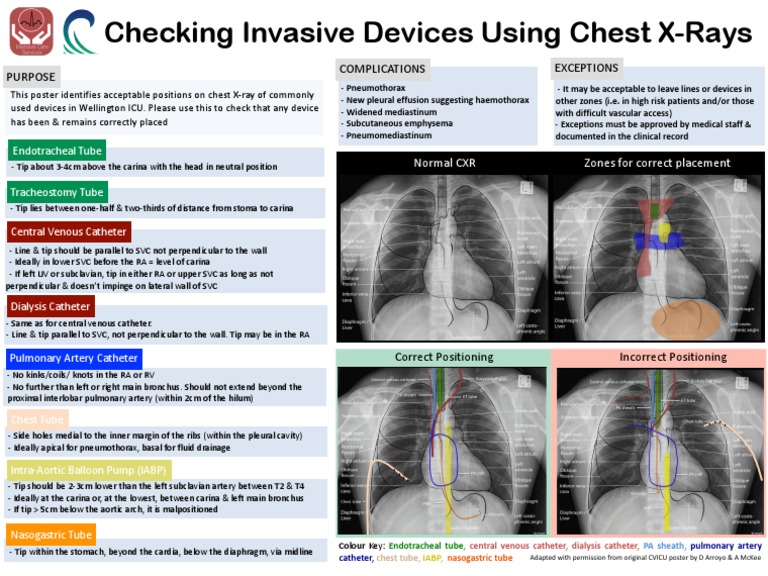 Invasive Devices On CXR | PDF | Lung | Thorax