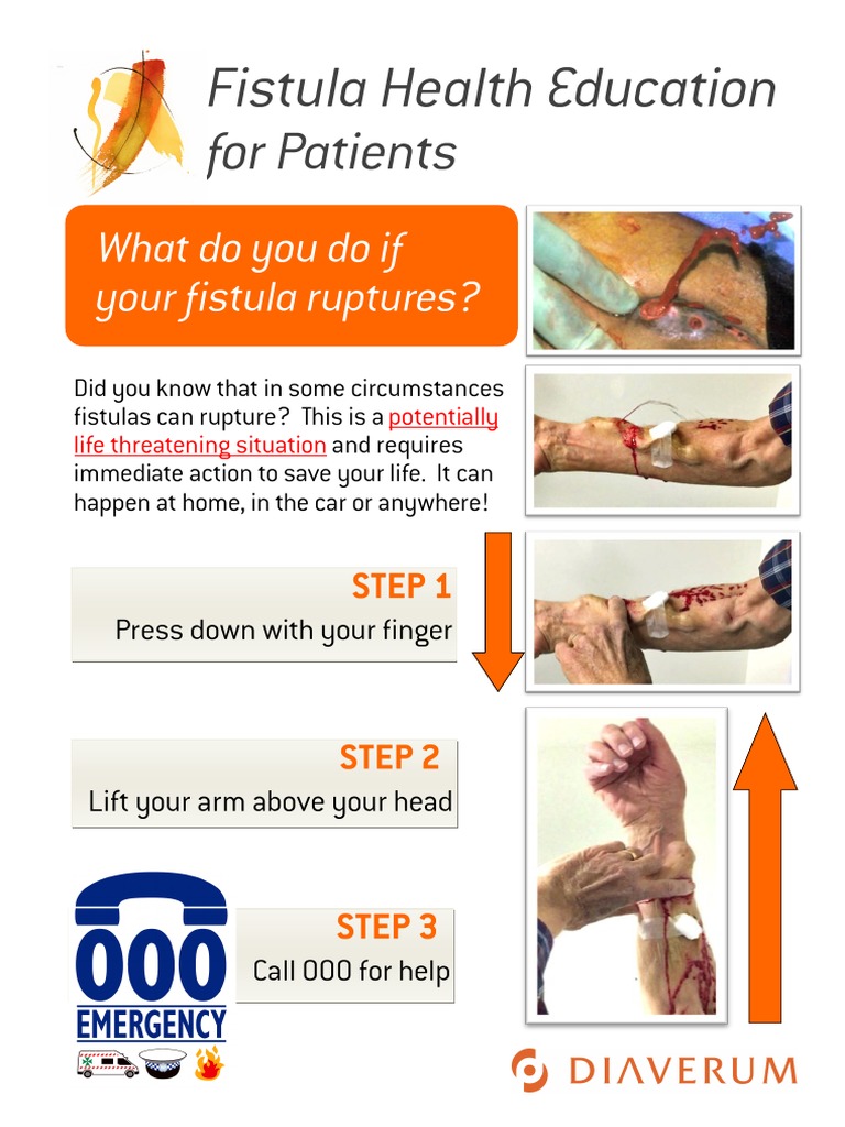 20161024-Fistula Health Education Poster | PDF | Medical Specialties ...