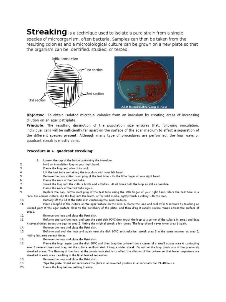 Streaking | Laboratories | Microbiology