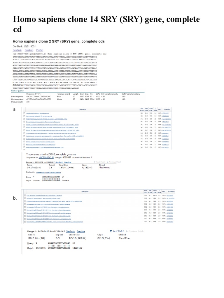 Homo Sapiens Clone 14 SRY (SRY) Gene, Complete CD | PDF