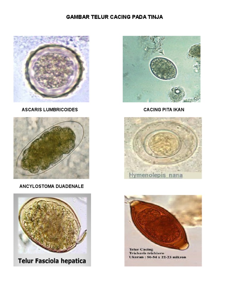 Gambar Telur Cacing Pada Tinja | PDF