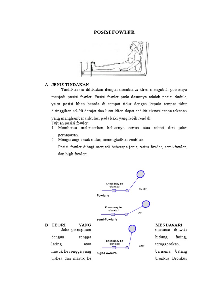 Fowler Position | PDF