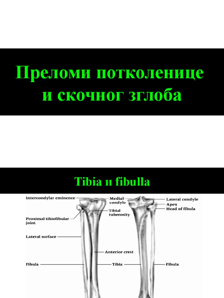 Prelomi Potkolenice I Skocnog Zgloba | PDF