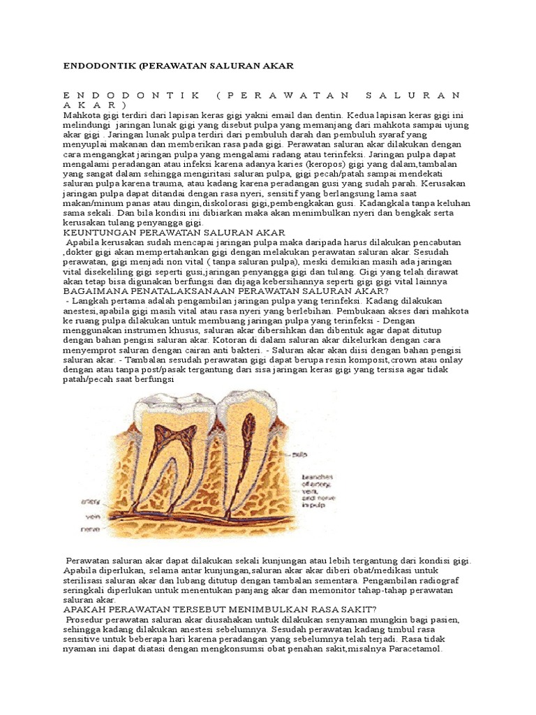 Perawatan Saluran Akar Gigi | PDF