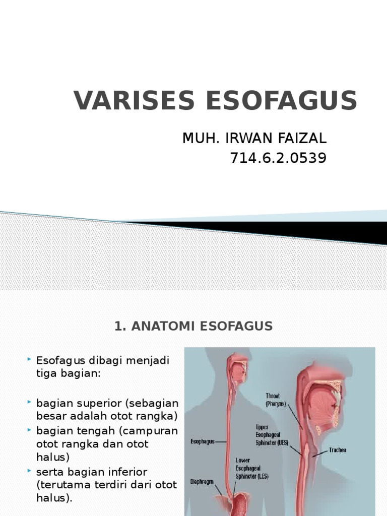 Varieses Esofagus | PDF