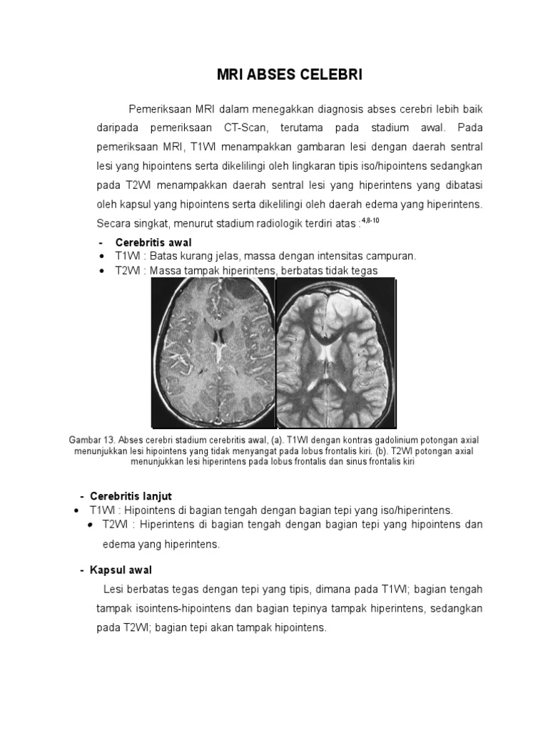 Diagnosa Abses Cerebri dengan MRI | PDF