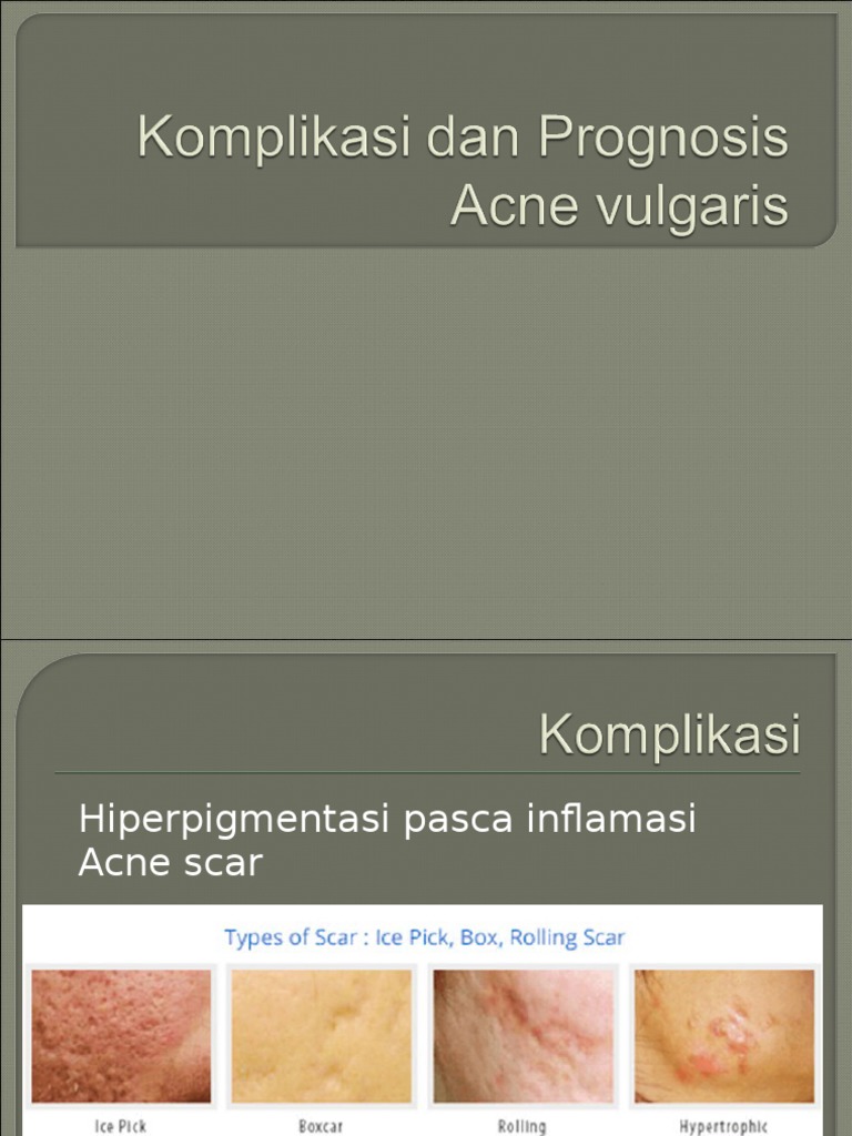 Komplikasi Dan Prognosis Acne Vulgaris | PDF