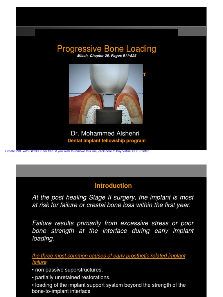 Progressive Bone Loading | PDF | Dental Implant | Bone