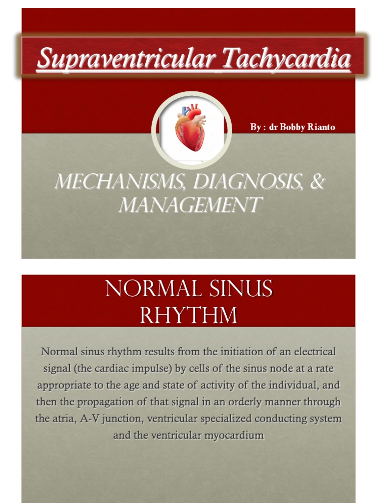 Supraventricular Tachycardia | PDF | Cardiac Arrhythmia | Cardiology