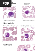Top 5 Leukogram Patterns Explained | PDF | White Blood Cell | Lymphocyte