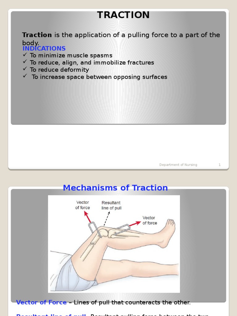 Traction and Fixator | PDF | Anatomical Terms Of Motion ...