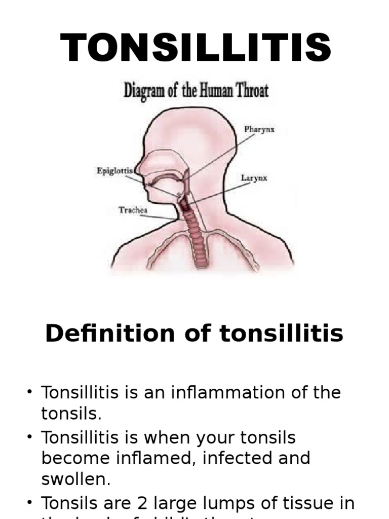 Tonsilitis (Medsurg) | PDF | Medical Specialties | Clinical Medicine