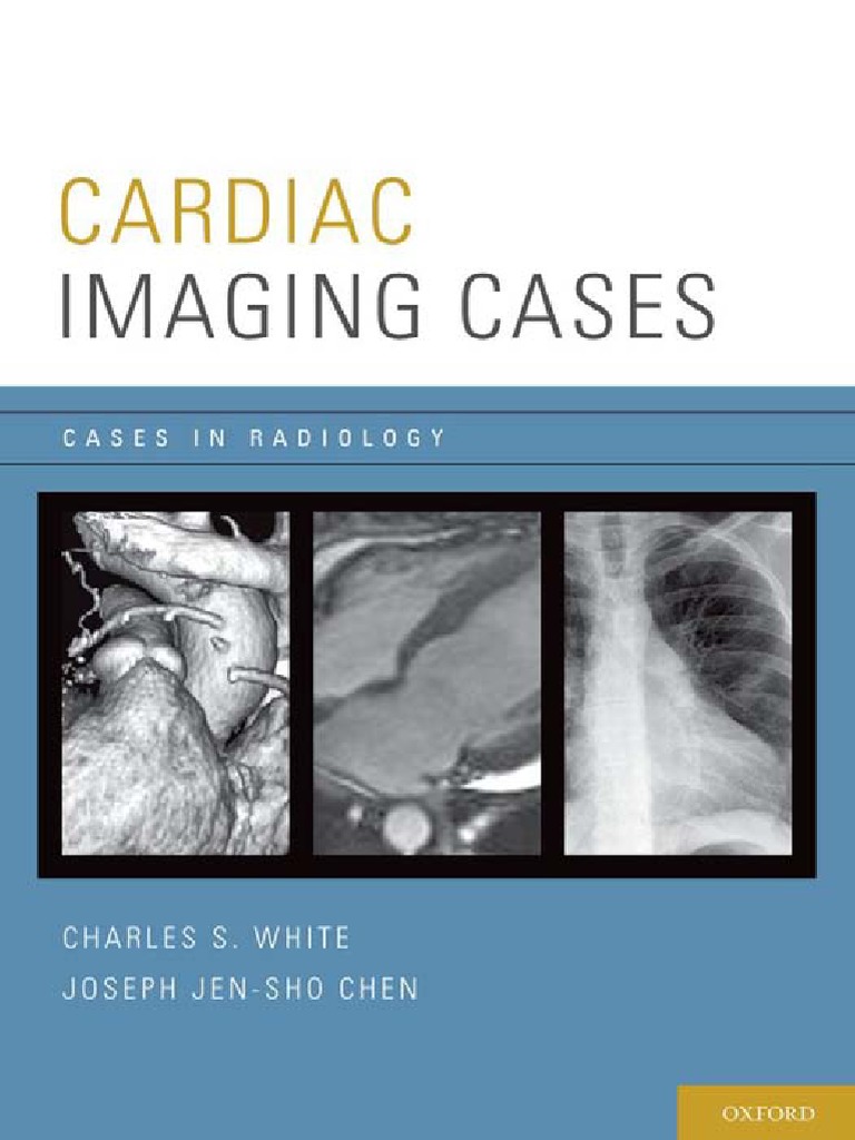 Cardiac Imaging Cases | Download Free PDF | Heart Valve | Coronary ...