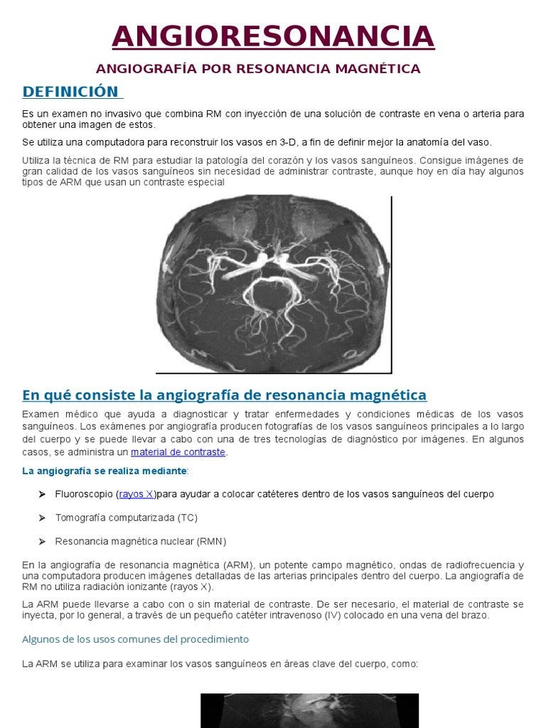 ANGIORESONANCIA Docxggg | PDF | Angiografía | Imagen de resonancia ...