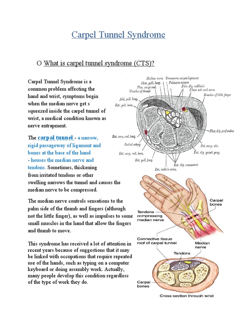 Carpel Tunnel Syndrome (CTS) | PDF | Carpal Tunnel Syndrome ...