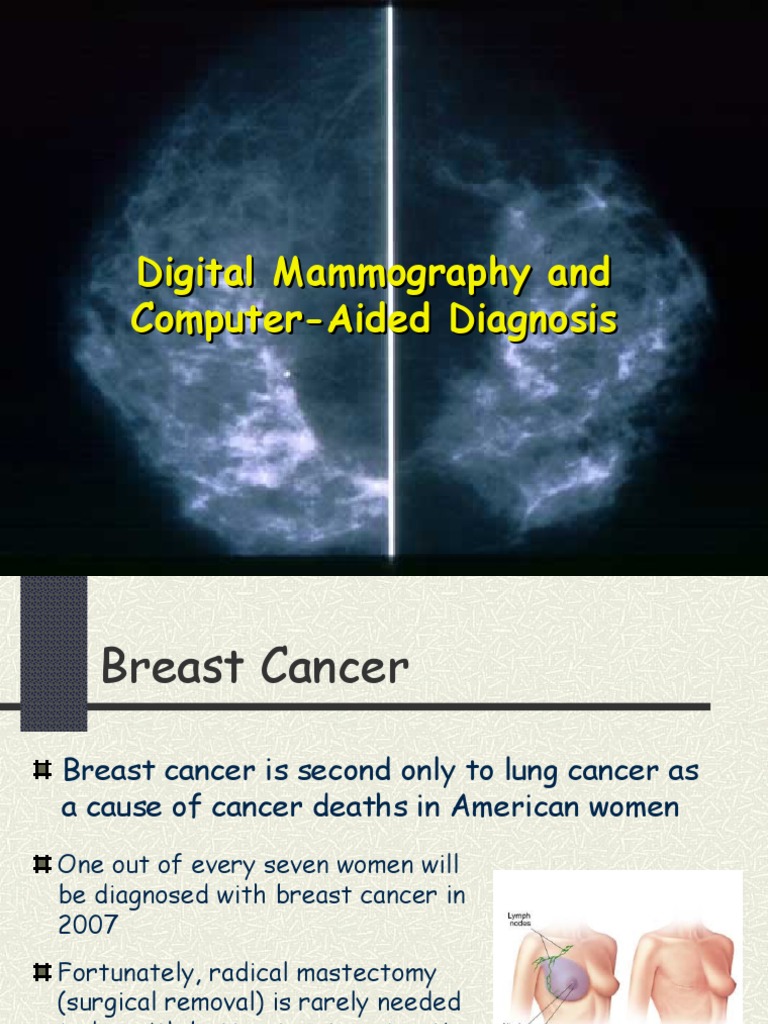 Digital Mammography and Computer-Aided Diagnosis | PDF
