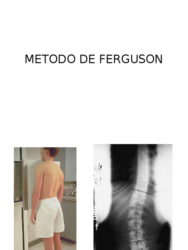 Metodo de Ferguson