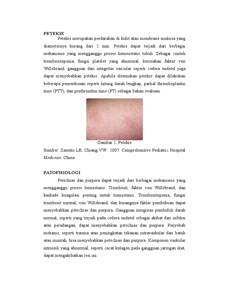 Petekie: Pengenalan, Patofisiologi, Diagnosis dan Evaluasi | PDF