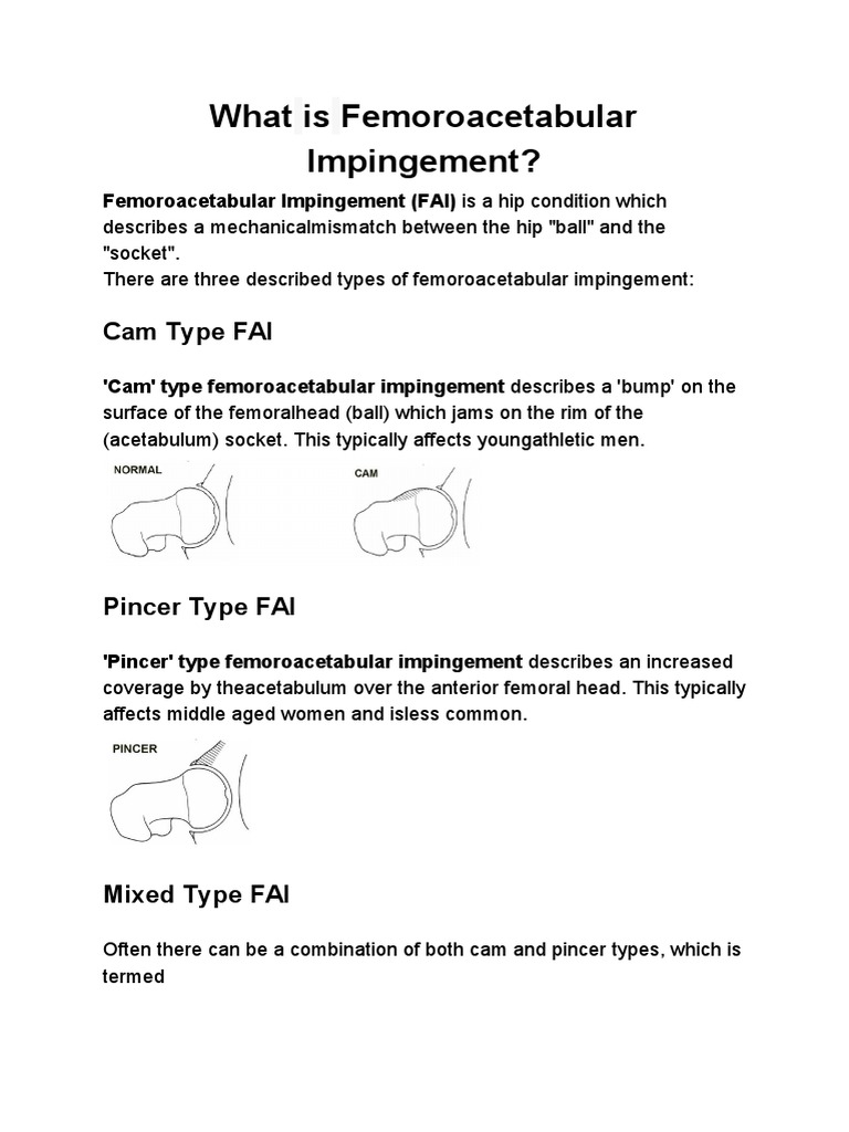 Hip Impingement Fai | PDF | Hip | Physical Therapy