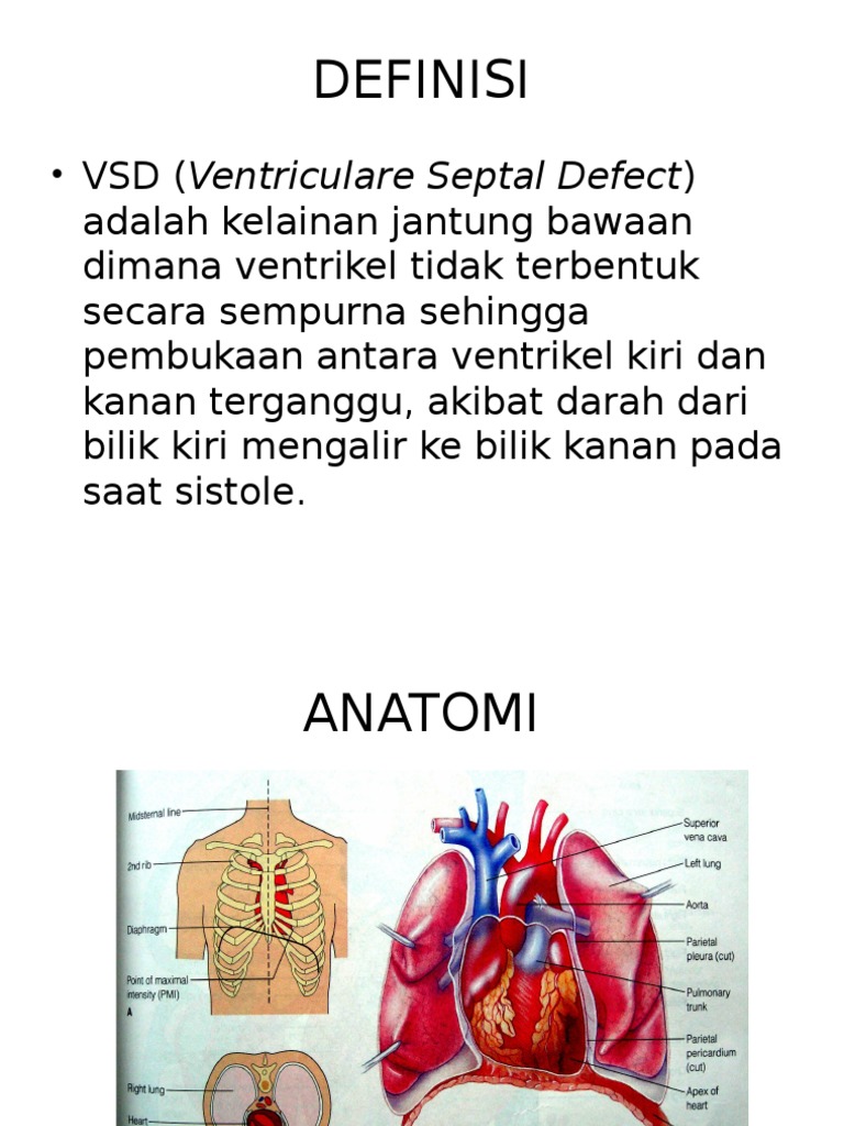 Anatomi Fisiologi VSD | PDF