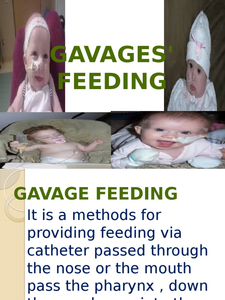 Gavage Feeding | PDF | Medical Specialties | Clinical Medicine