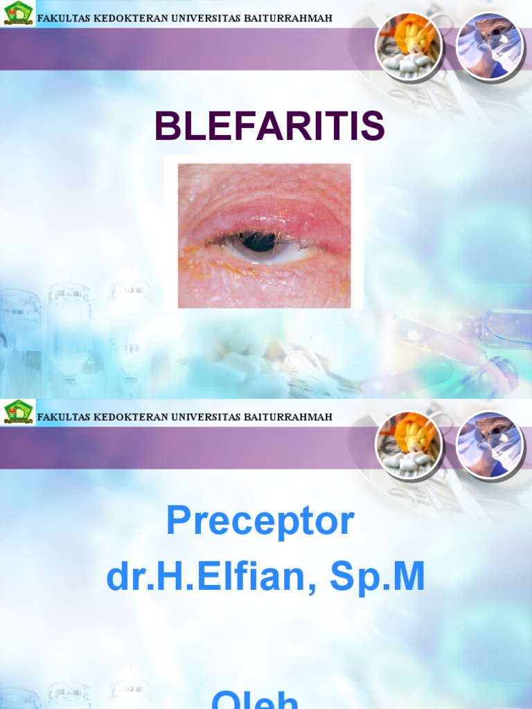 Blefaritis | PDF