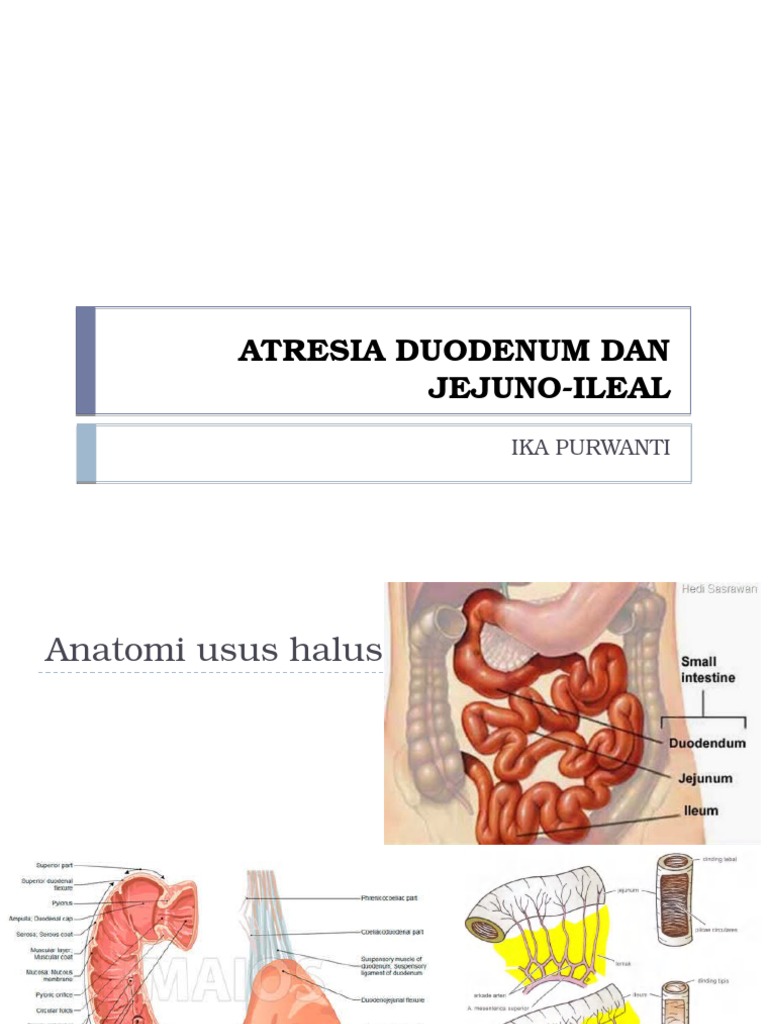 Atresia Duodenum Dan Jejunoileal | PDF