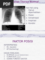 Radiologi Thorax Normal | PDF