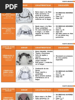 Tipos de Líneas de Terminación Dental | PDF | Dentadura postiza | Diente