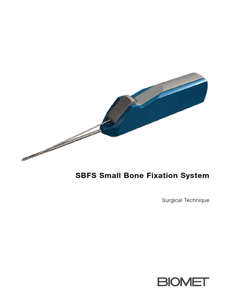SBFS Small Bone Fixation System Surgical Technique | PDF | Surgery ...