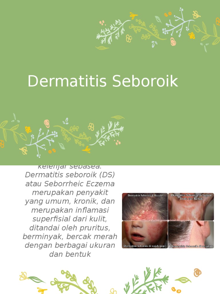 Dermatitis Seboroik | PDF