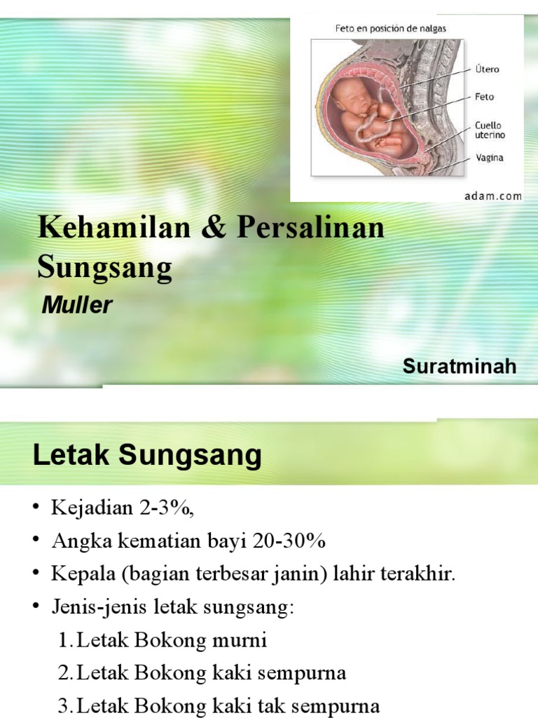 9 Persalinan Sungsang | PDF