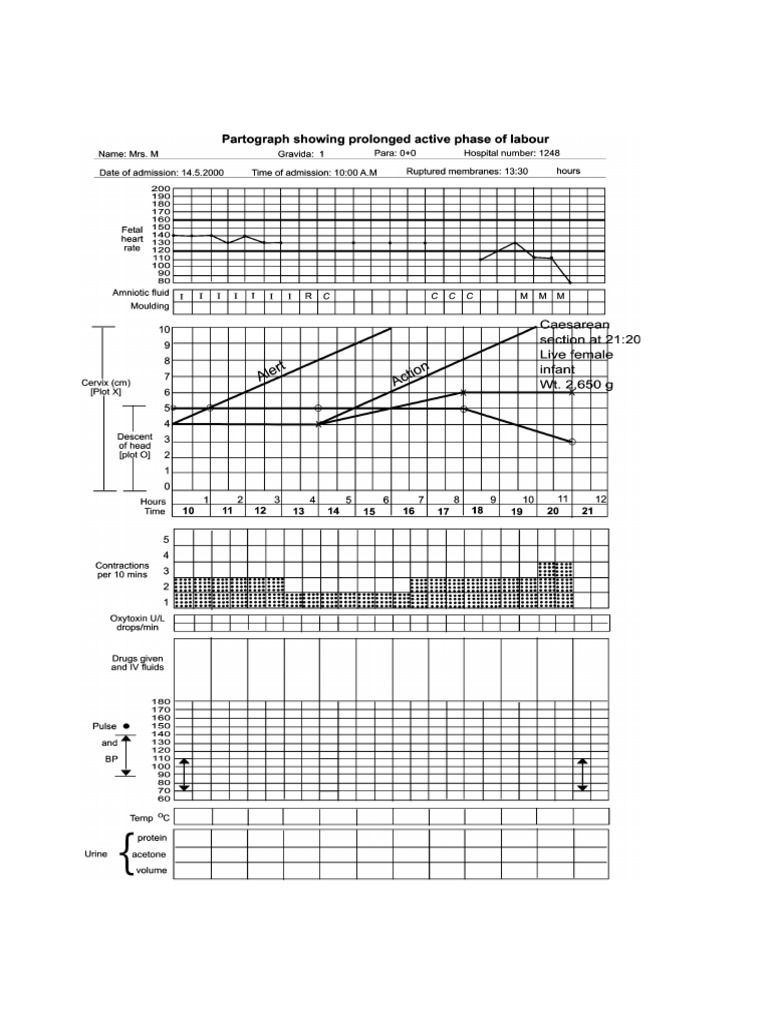 Prolonged Active Phase | PDF