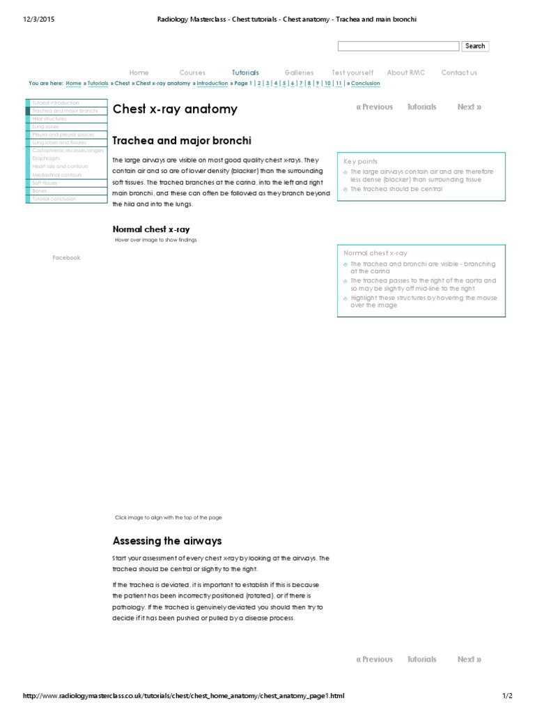 Radiology Masterclass - Chest Tutorials - Chest Anatomy - Trachea and ...